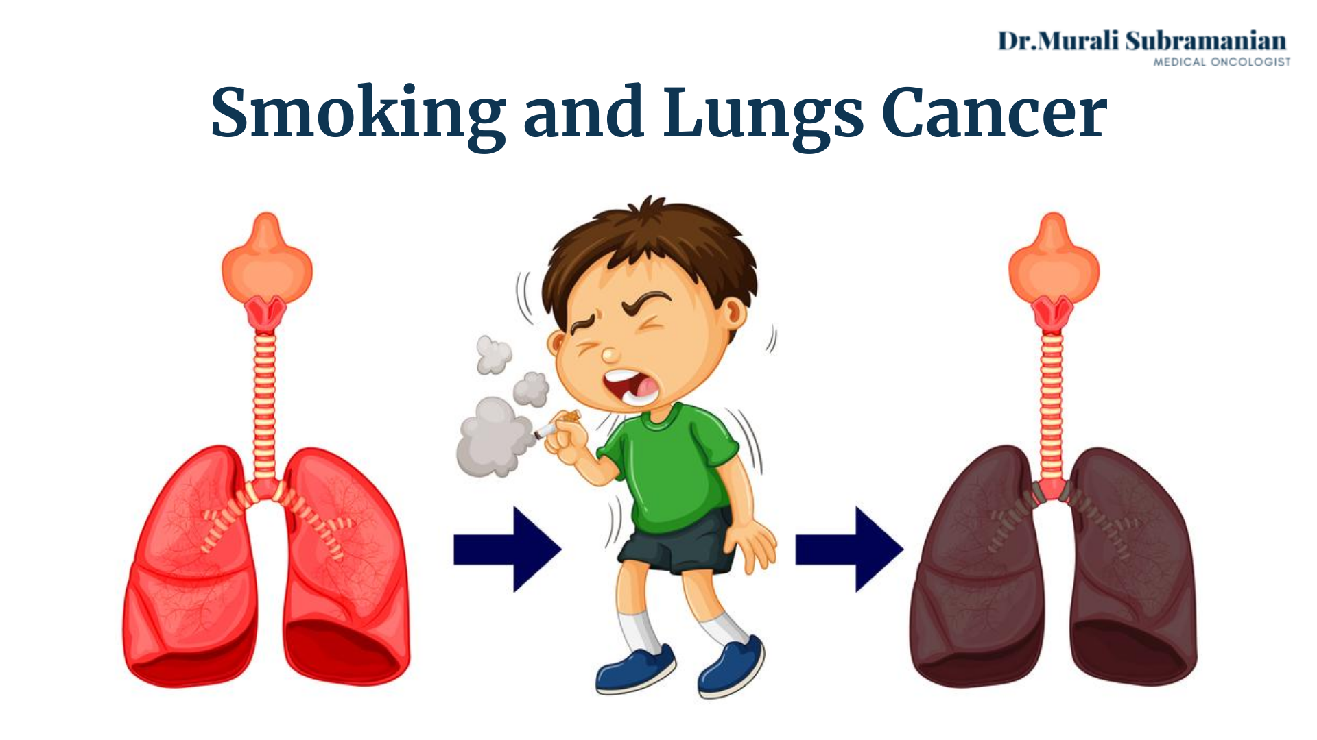 Smoking and Lungs Cancer | Lung Cancer Treatment in Bangalore